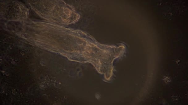 89 Rotifers Videos, Royalty-free Stock Rotifers Footage | Depositphotos
