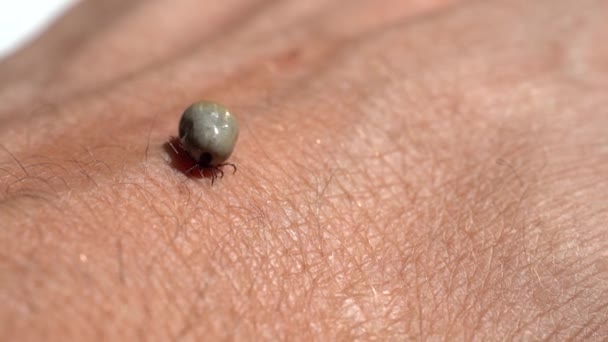 34 Enfermedades parasitarias Videos, Royalty-free Stock Enfermedades ...