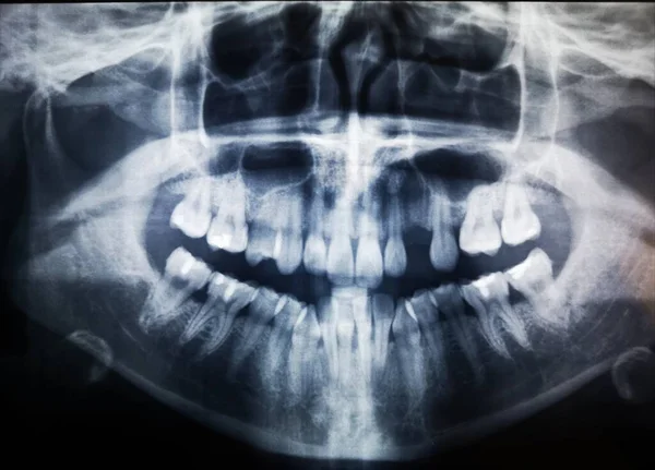 Radiographia Stock Photos, Royalty Free Radiographia Images | Depositphotos