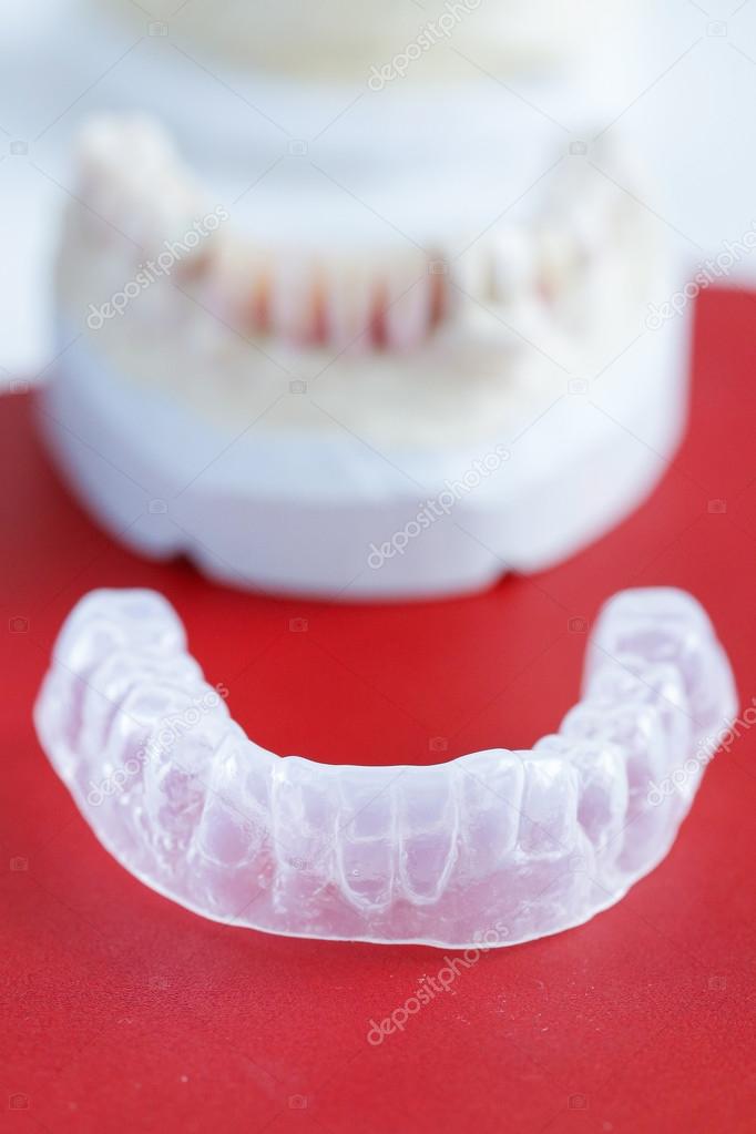 Invisalign, invisible plastic teeth aligner — Stock Photo © zlikovec ...