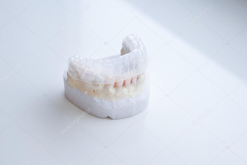 Invisalign, invisible plastic teeth aligner Stock Photo by ©zlikovec ...