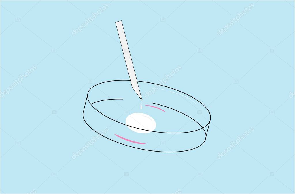 Ilustración Vectorial Del Proceso Fertilización Vitro Fiv Vector de stock por ©Gegambar 456622966