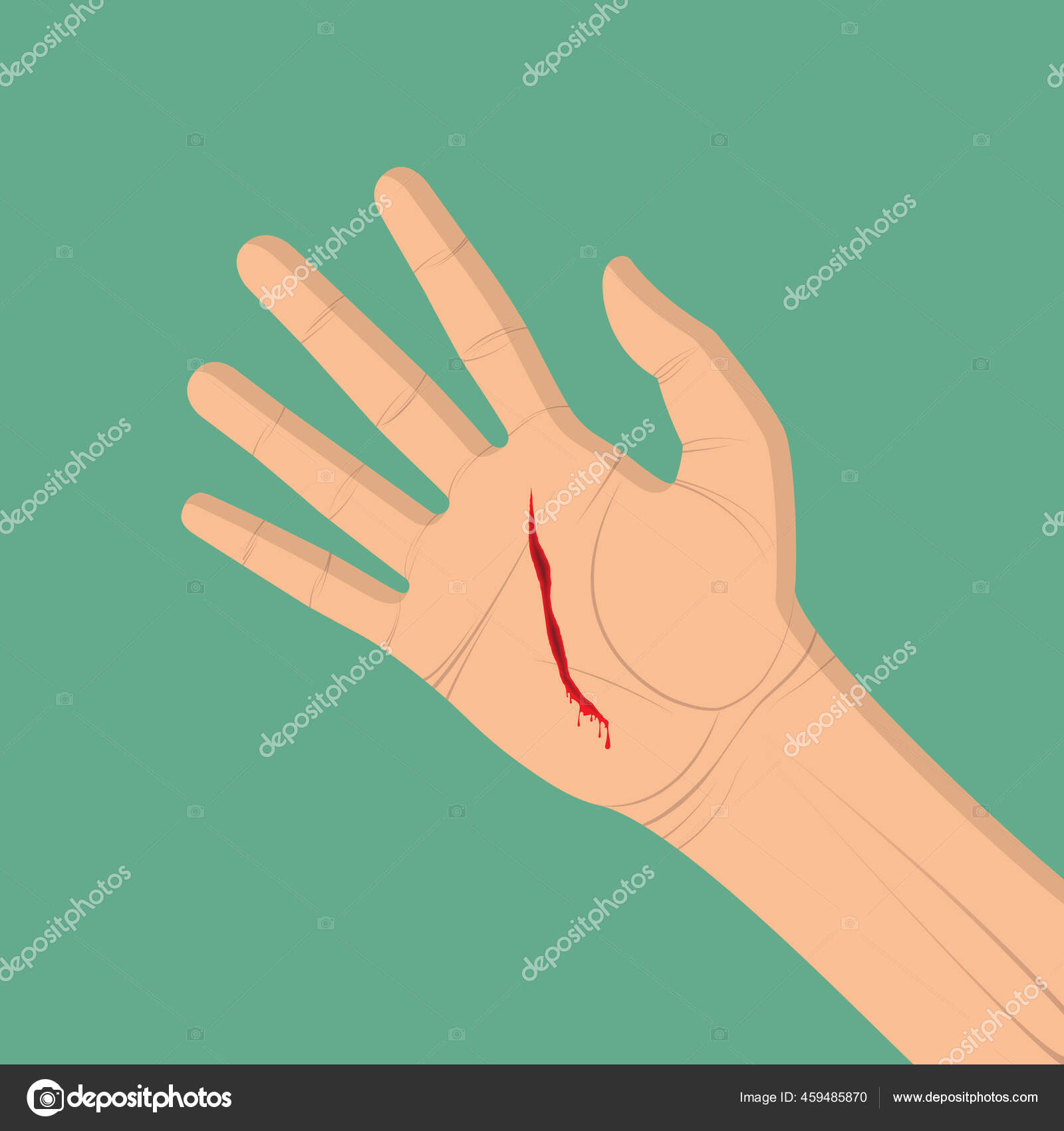 Herida Abierta Palma Vector de stock por ©NSGY 459485870
