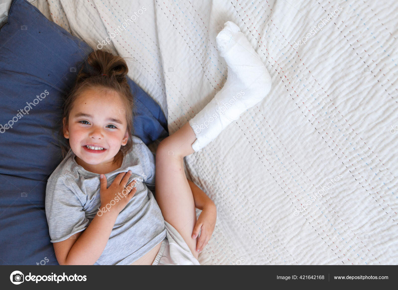 Broken Leg Close Cast Feet Exercises Repair Strengthen Muscles Damage ...