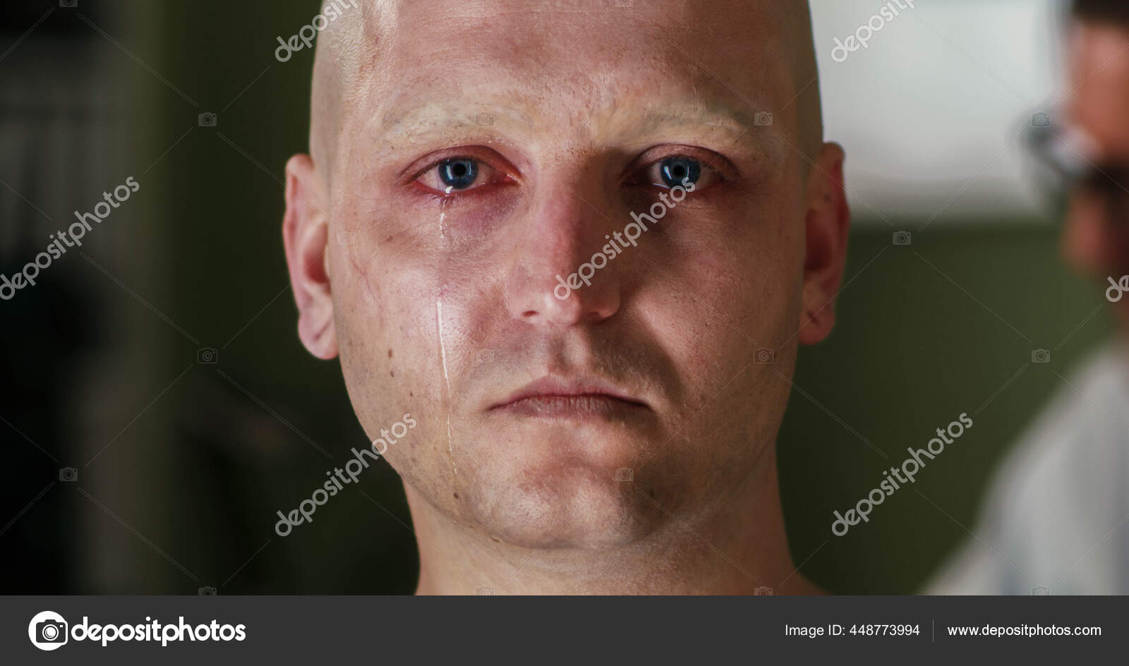 Crying cancer patient looking at camera — Stock Photo ...