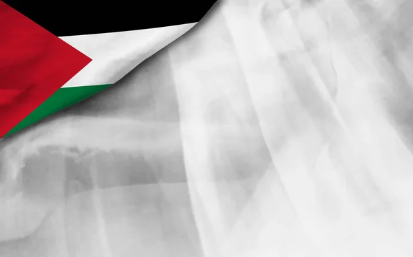 White Background Palestine Flag Left Illustration Stock Photo by ...