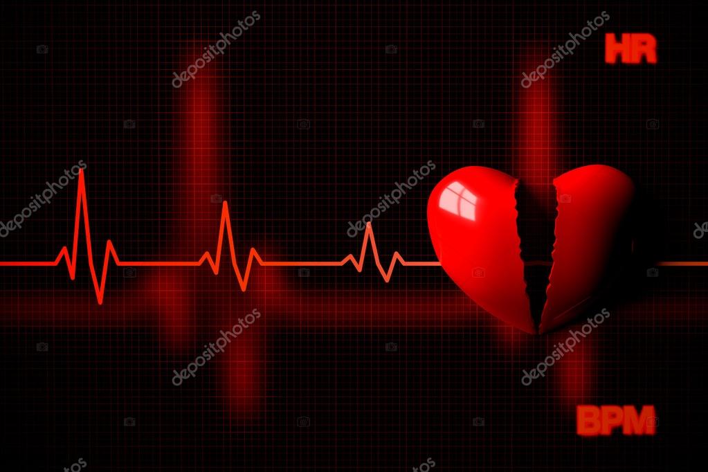 Concepto de Insuficiencia Cardiaca Ilustrado por Corazón Roto ...
