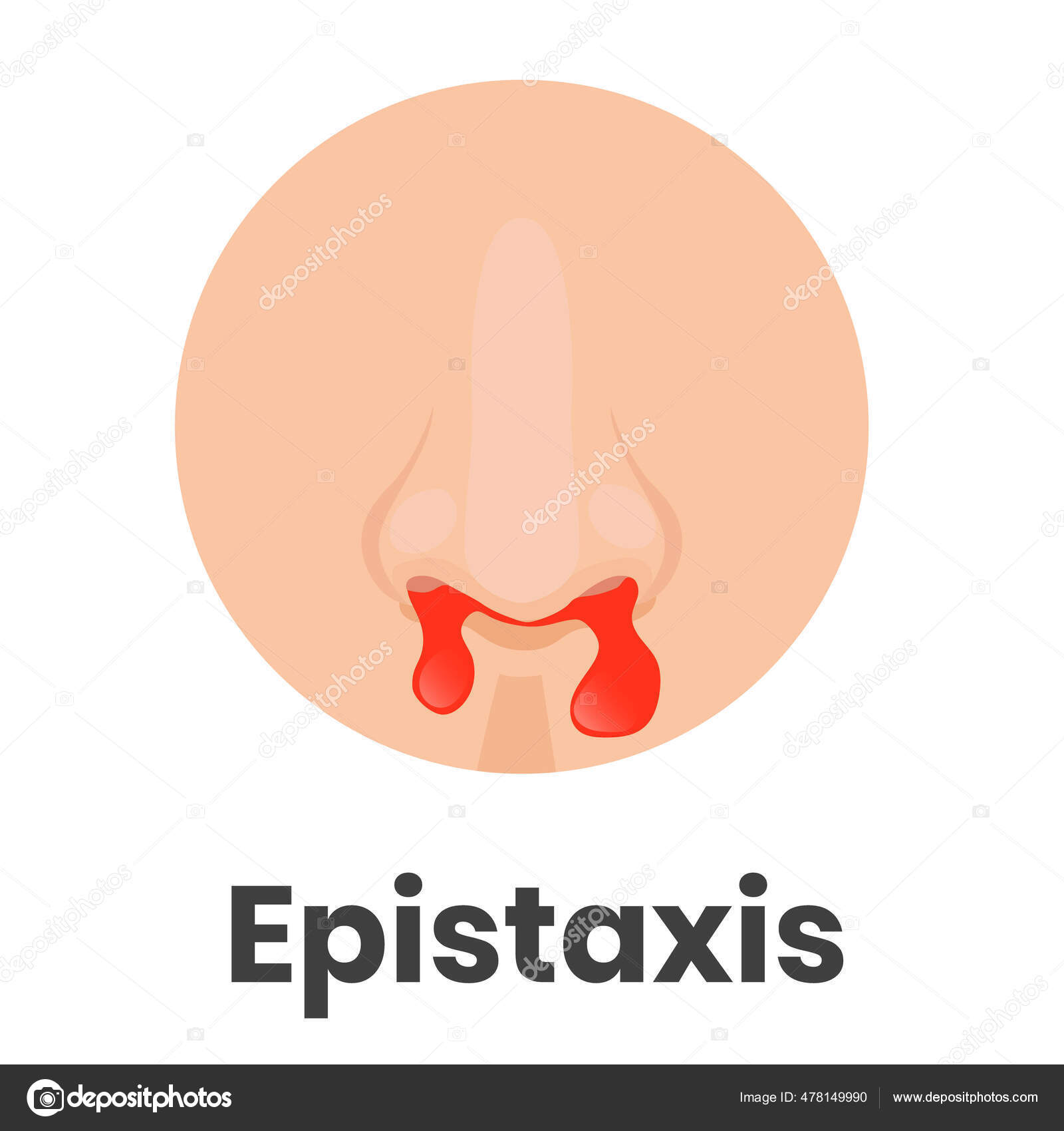Nosebleeds Icon Epistaxis Concept Bleeding Human Nose Vector Illustration Stock Vector by ...