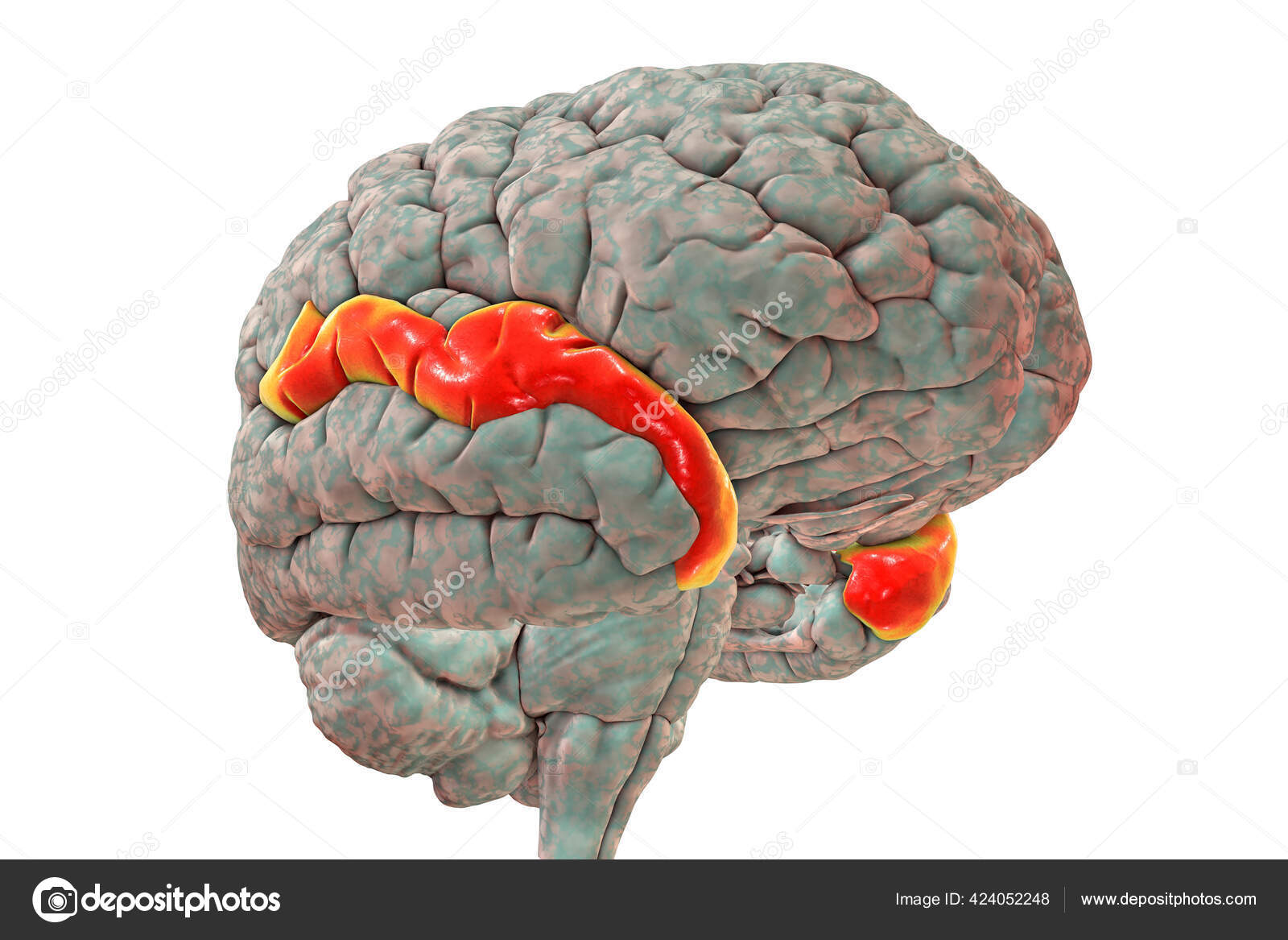 Human Brain Highlighted Superior Temporal Gyrus Illustration Located ...