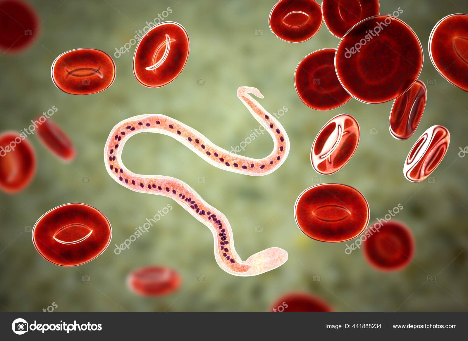 Wuchereria Bancrofti