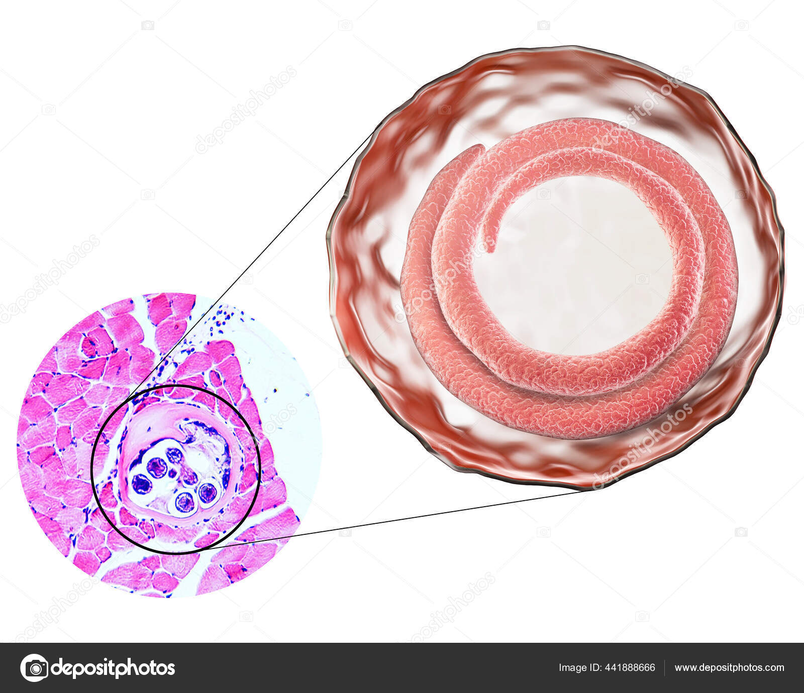 Illustration Micrograph Transverse Section Cyst Muscle Containing ...
