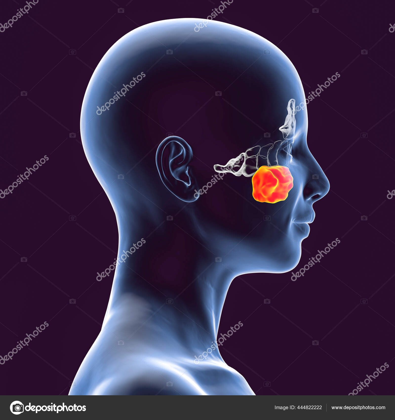 Anatomy Paranasal Sinuses Illustration Showing Female Highlighted ...
