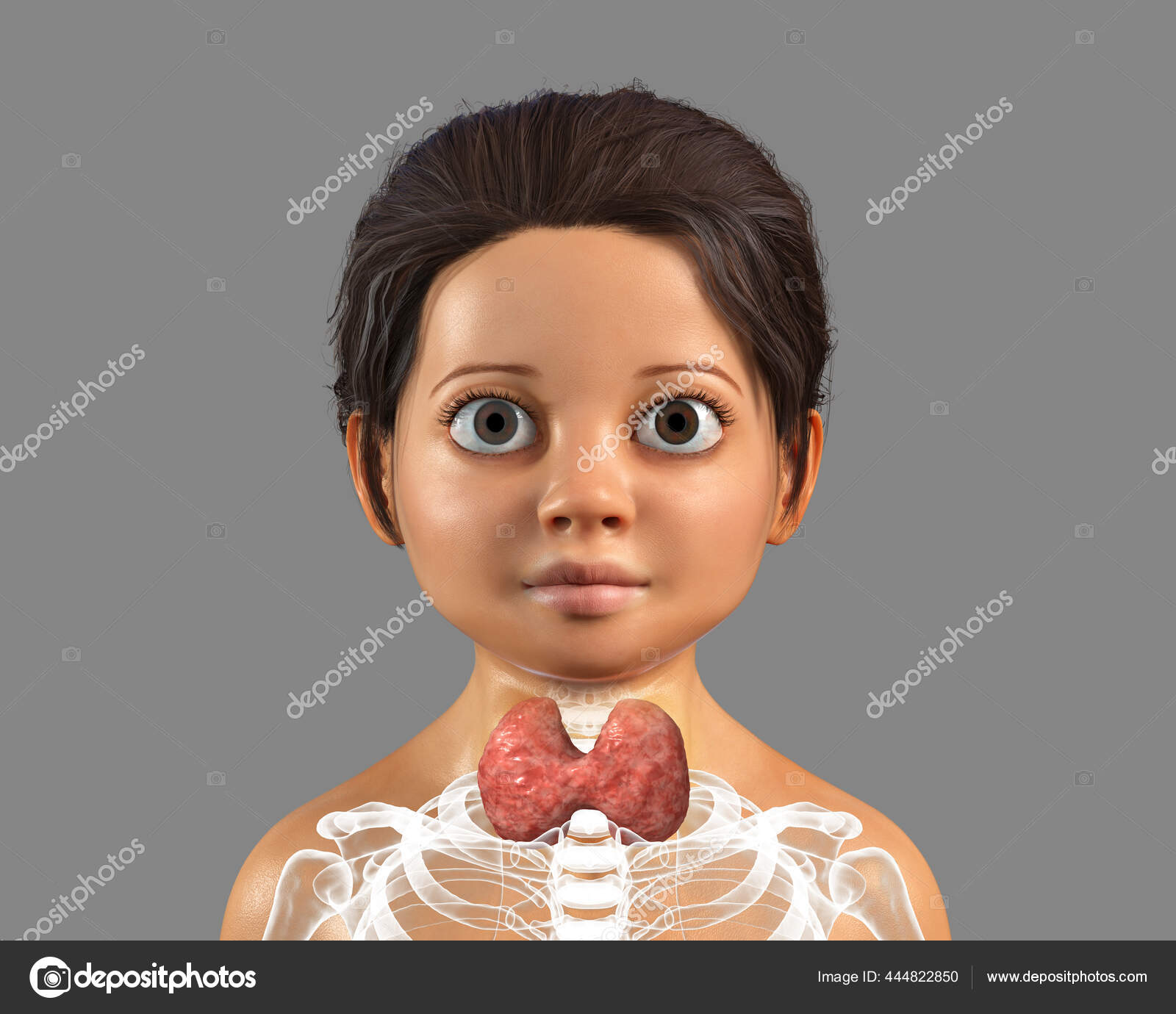 Hyperthyroidism In Children