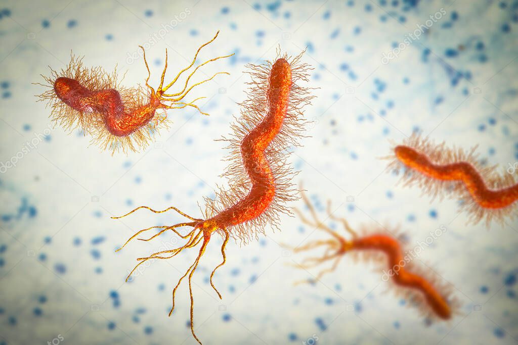 Helicobacter pylori, bacteria que coloniza el estómago y se asocia con úlcera gástrica y ...