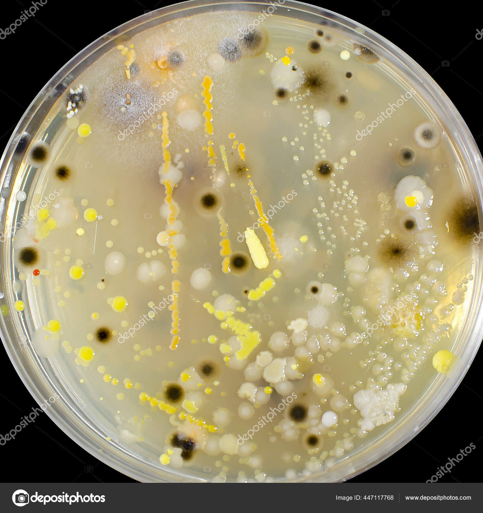 Tipos De Bacterias Na Placa De Petri