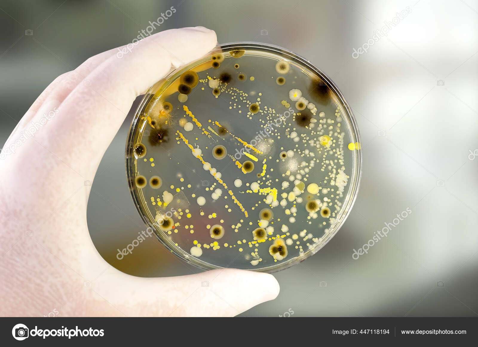 Colonies Different Bacteria Mold Fungi Grown Petri Dish Nutrient Agar ...