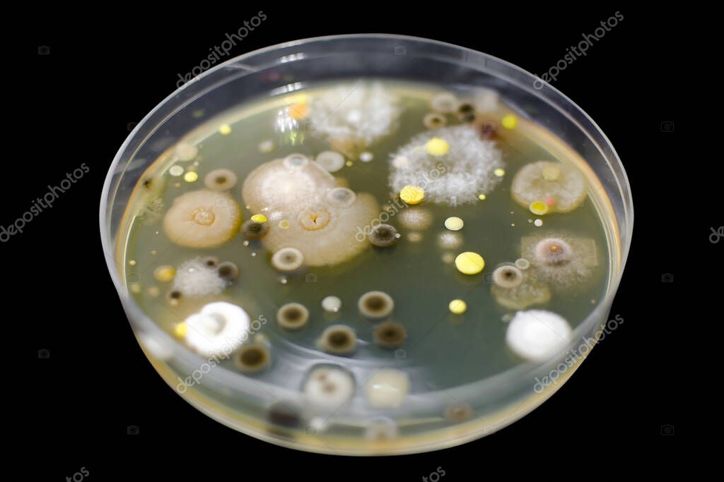 Colonias de diferentes bacterias y moldes de aire atmosférico ...