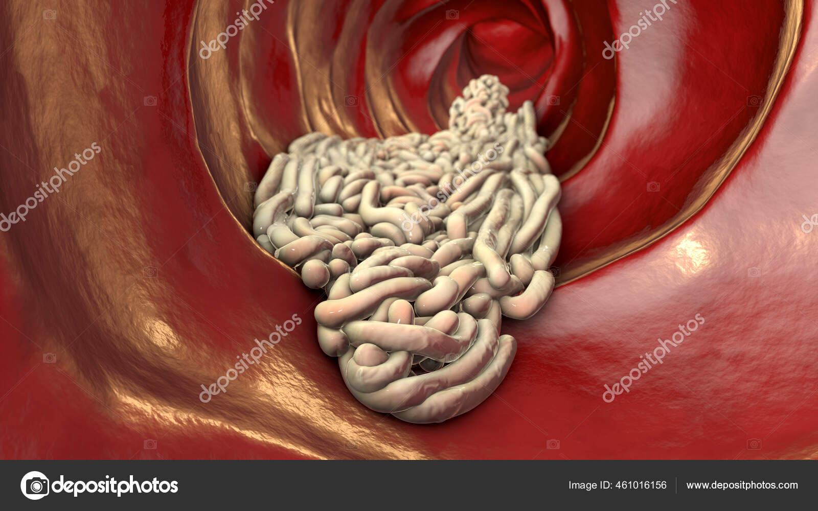 Parasitic Worms Lumen Intestine Illustration Growth Multiplication ...