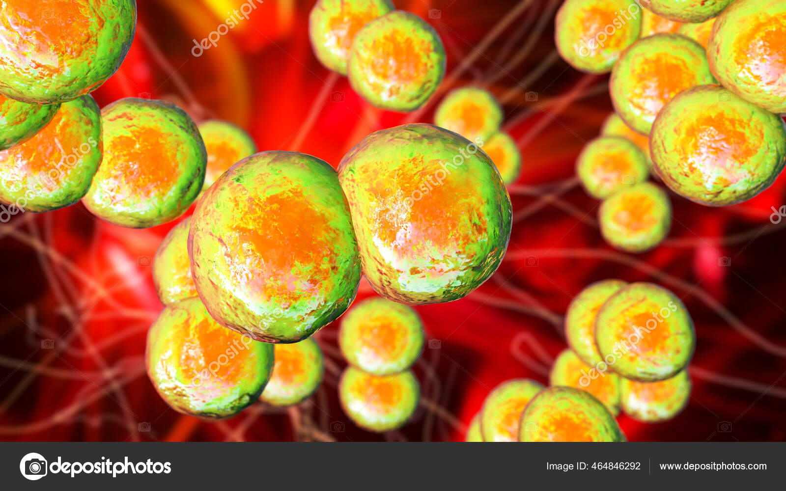 Moraxella Catarrhalis Gram Stain
