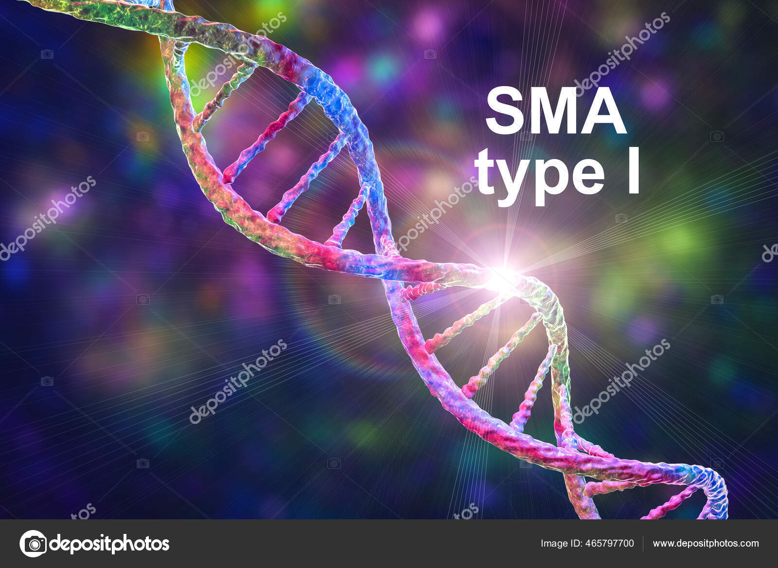 Fotos de Atrofia Muscular Espinal Sma Tipo Trastorno Neuromuscular ...