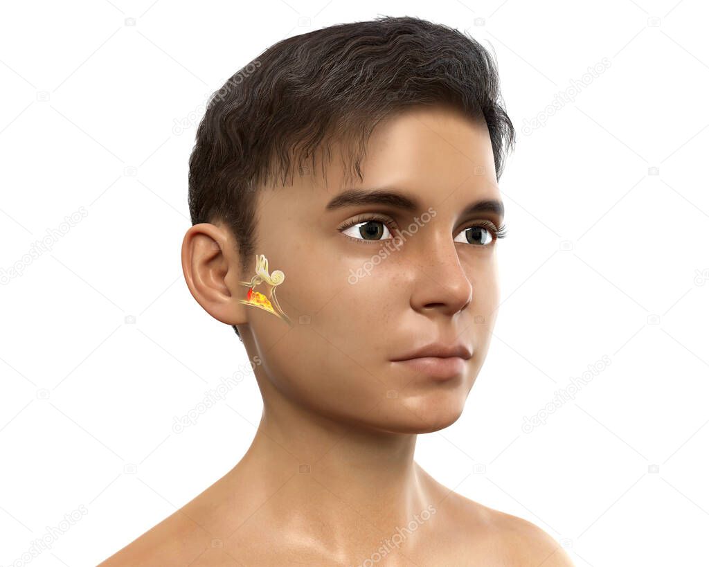 Otitis media, un grupo de enfermedades inflamatorias del oído medio ...