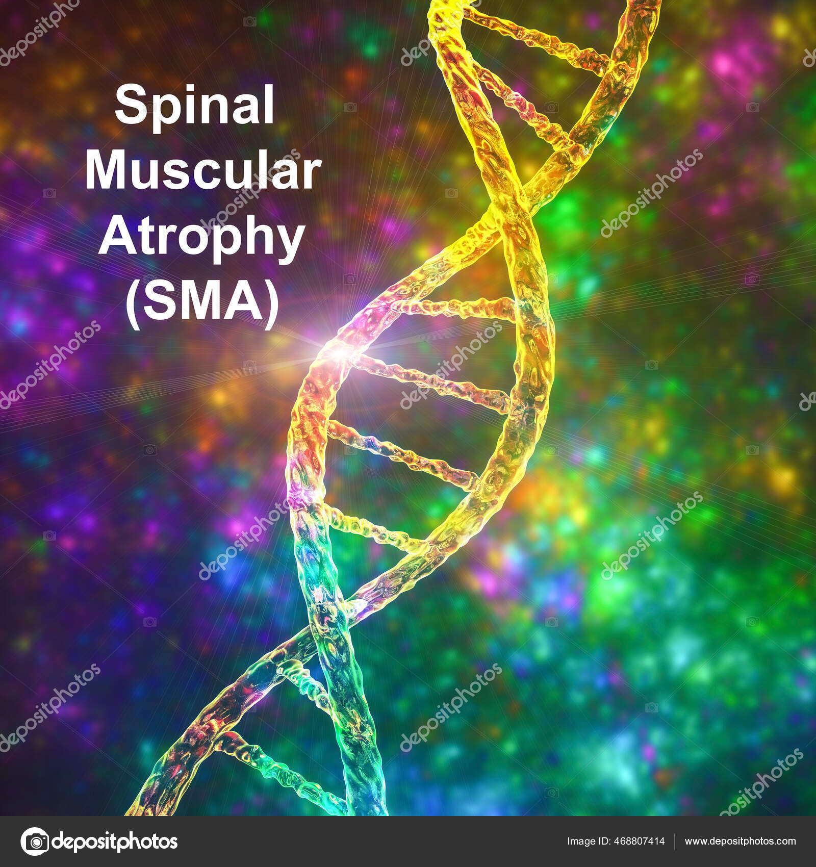 Spinal Muscular Atrophy Sma Genetic Neuromuscular Disorder Progressive ...