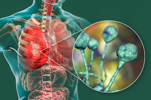 Mucor Stock Photos, Royalty Free Mucor Images | Depositphotos