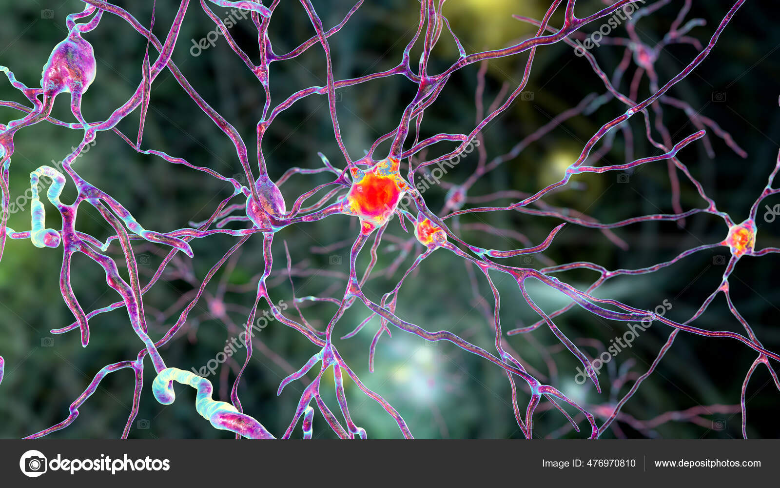 Neuronas Del Estriado Dorsal Ilustración Estriado Dorsal Núcleo Los ...