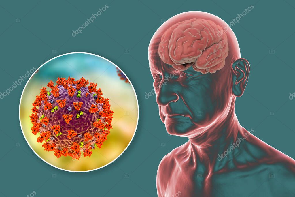 Covid-19 y demencia. Secuelas neuropsiquiátricas de Covid-19 ...