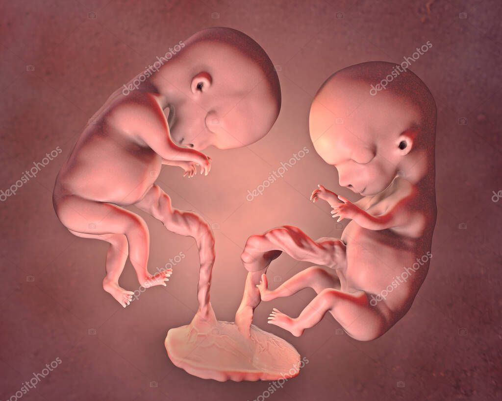 Gemelos monocigóticos en útero con placenta única, ilustración en 3D ...