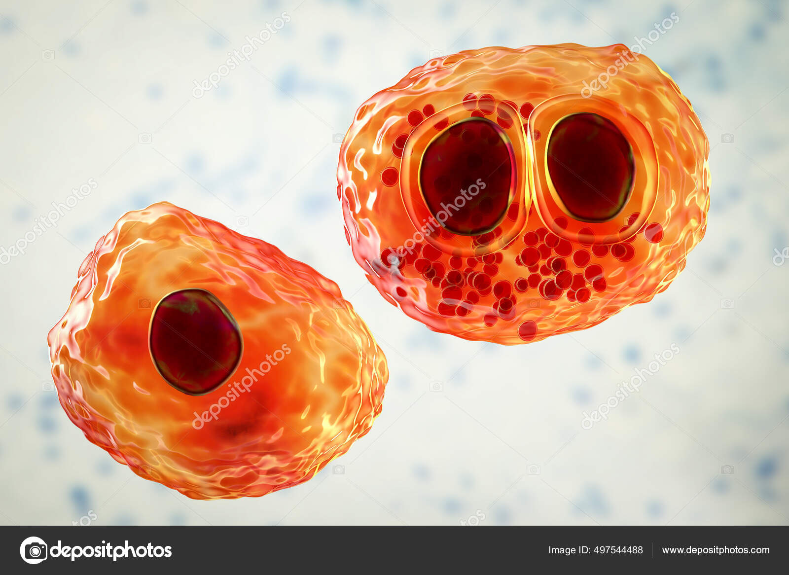 Cytomegalovirus Induced Changes Human Cell Known Owl's Eye Cell ...