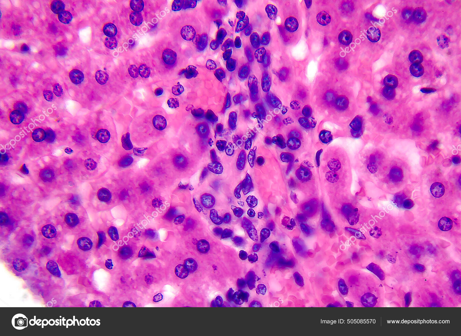 Coccidiosis Coccidia Liver Light Micrograph Photo Microscope Stock ...