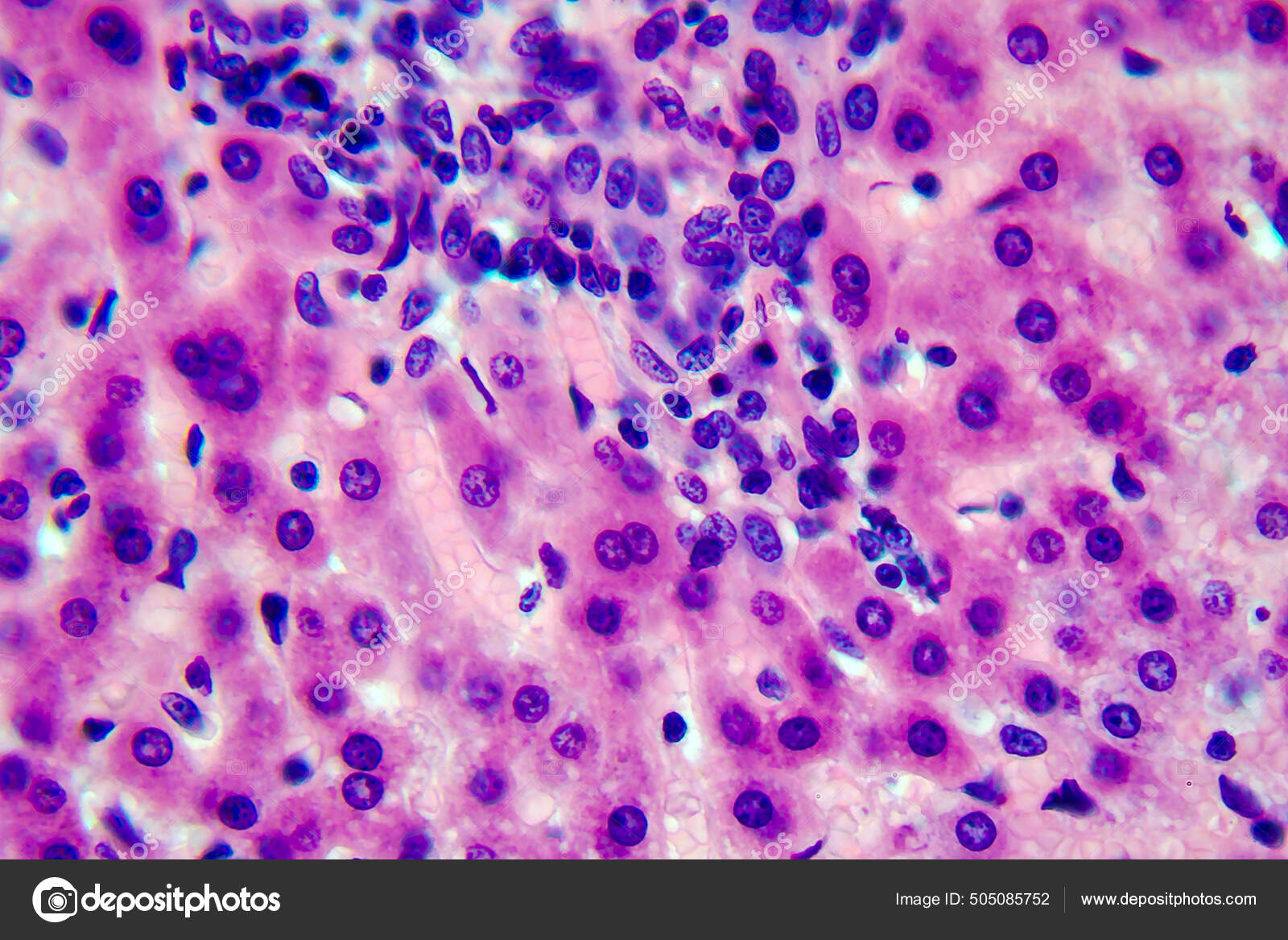 Coccidiosis Coccidia Liver Light Micrograph Photo Microscope Stock ...