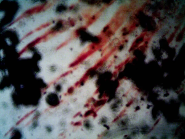 Fotos de Blood collage, Imagens de Blood collage sem royalties ...