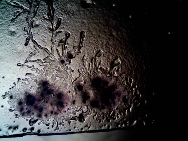 Mold under the microscope Stock Photos, Royalty Free Mold under the ...