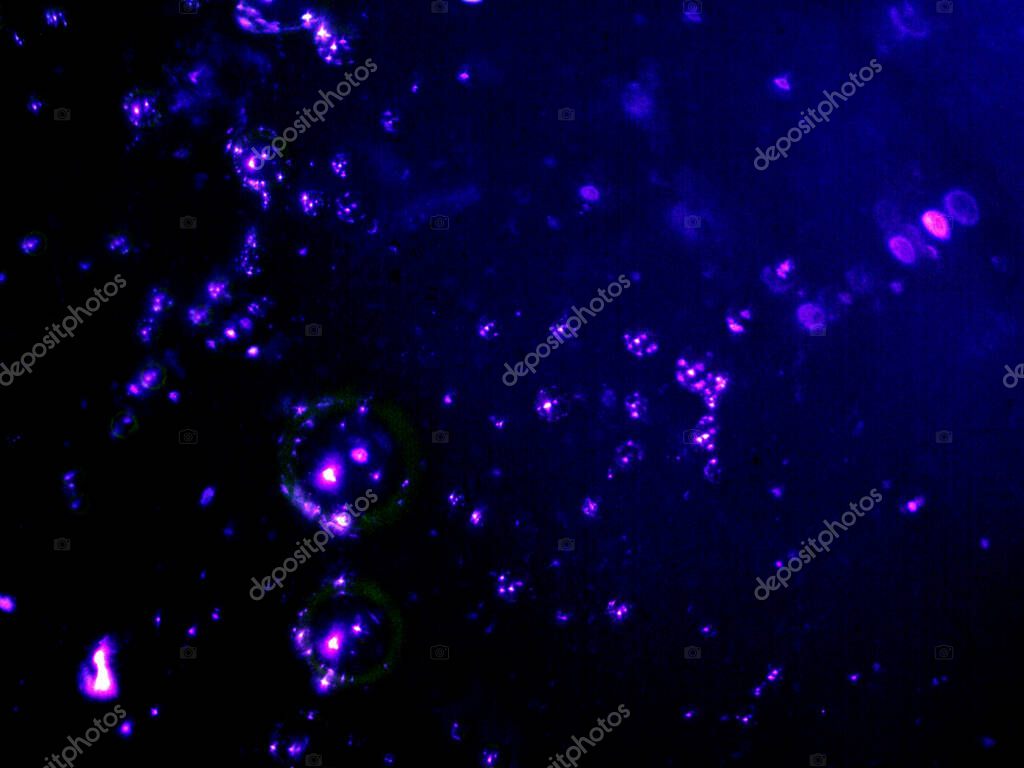 Foto de BHO, aceite de hachís buthan hecho a sí mismo. Foto por ...