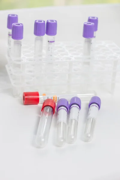 Allergen testing Stock Photos, Royalty Free Allergen testing Images ...