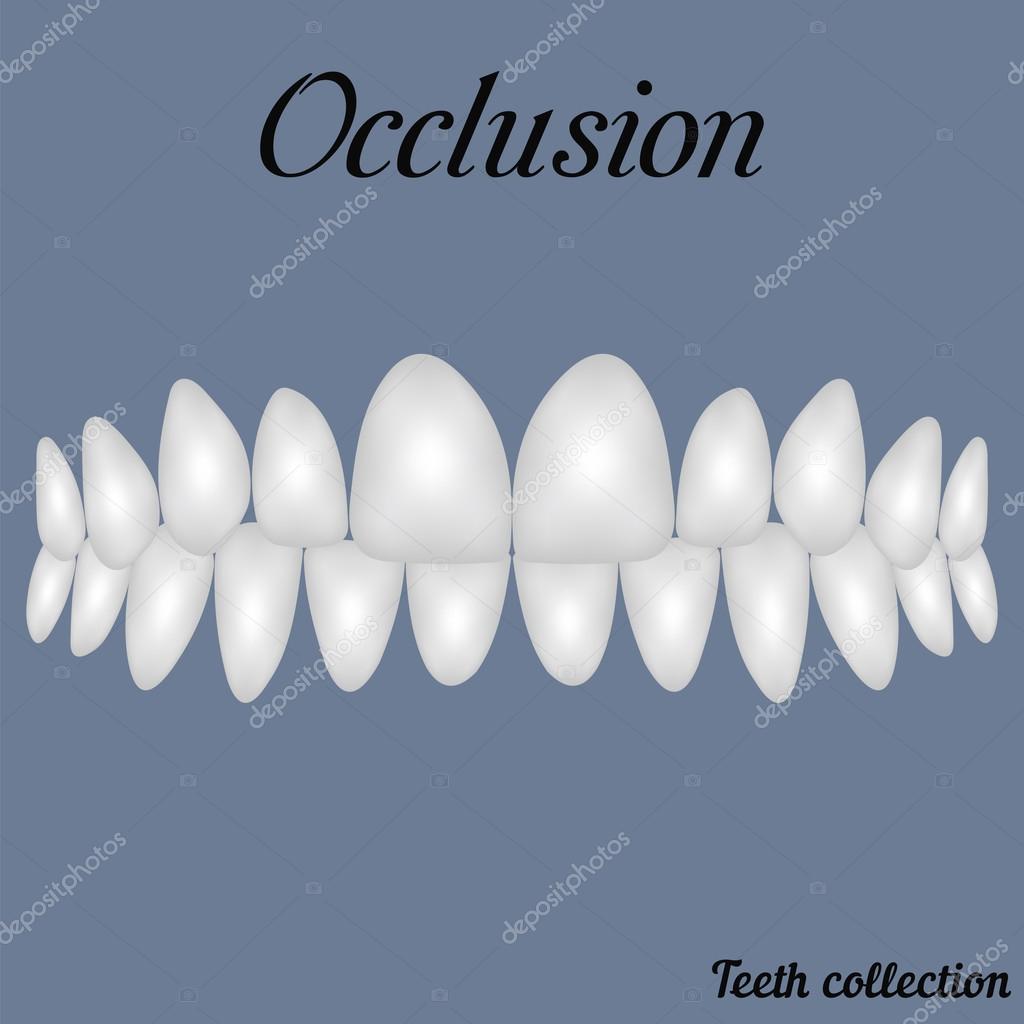 Occlusion clenched teeth Stock Vector Image by ©koksikoks #111385414