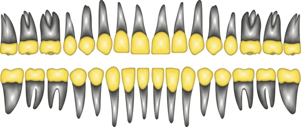 Gold tooth Vector Art Stock Images | Depositphotos