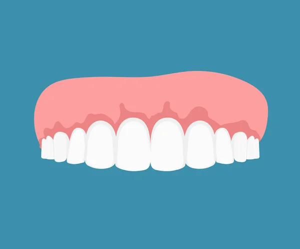 Bleeding gums Vector Art Stock Images | Depositphotos