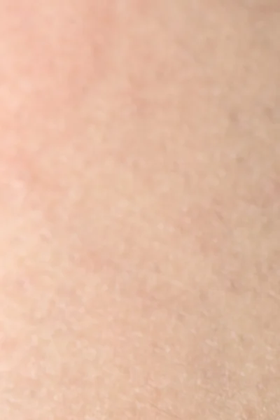 Human skin texture with black hairs on the skin for healthy back ...