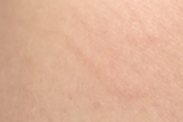 Human skin texture with black hairs on the skin for healthy back ...