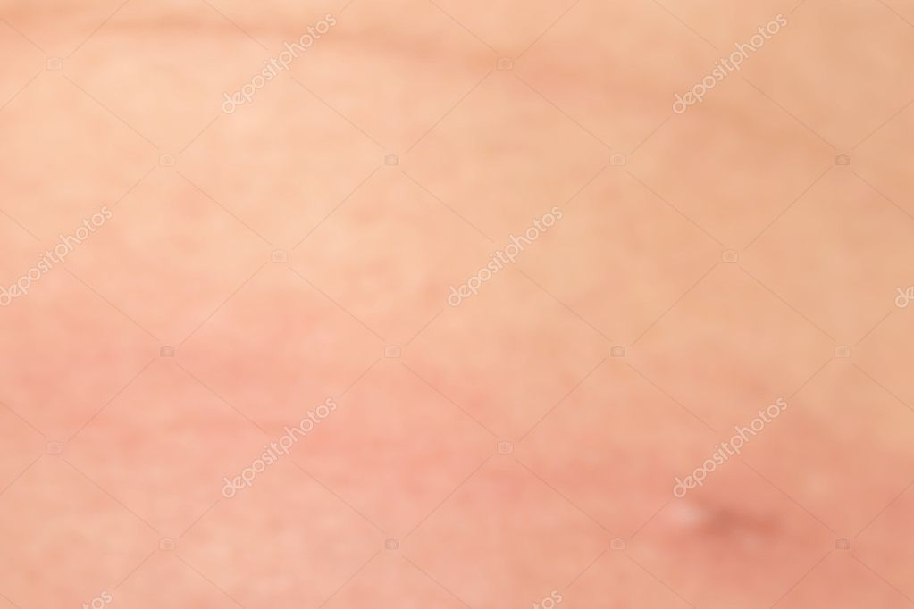 Human skin texture with black hairs on the skin for healthy back Stock ...