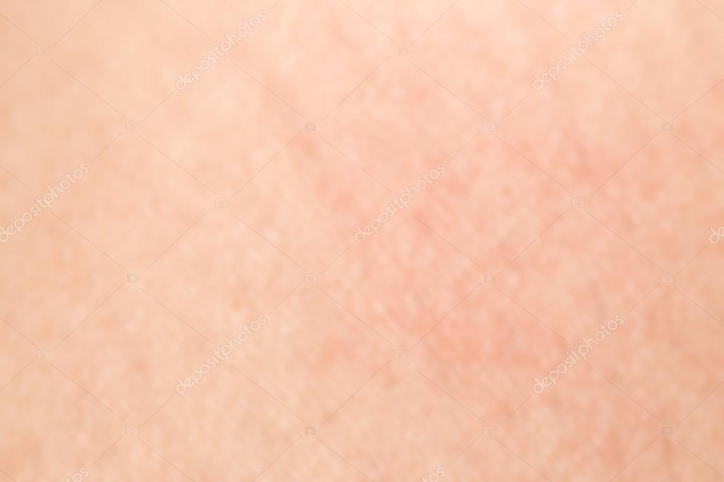 Human skin texture with black hairs on the skin for healthy back ...