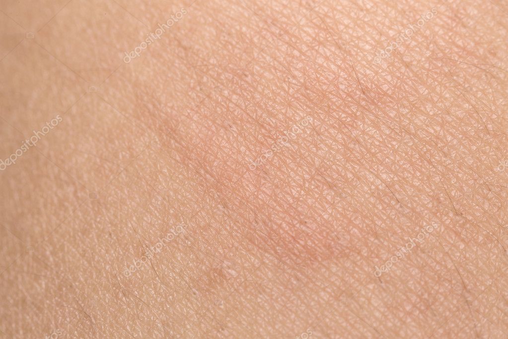 Human skin texture with black hairs on the skin for healthy back Stock ...