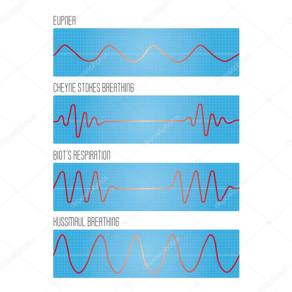 Graph of breathing, the pathological types of breathing — Stock Vector ...