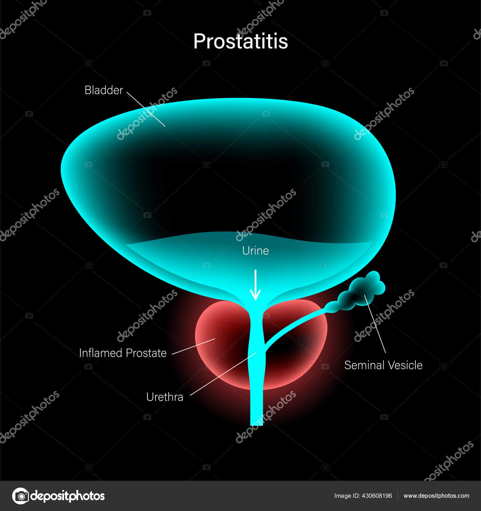 Prostatitis inflammation problem Stock Vector Image by ©Pikovit #430608196