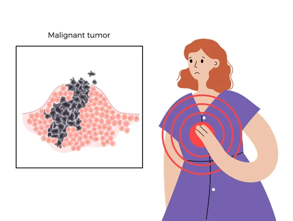 Breast cancer cells Vector Art Stock Images | Depositphotos