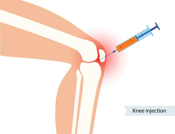 Knee injection Vector Art Stock Images | Depositphotos