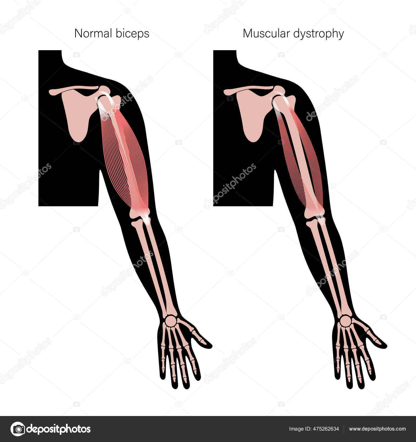 Human arm muscles Stock Vector by ©Pikovit 475262634